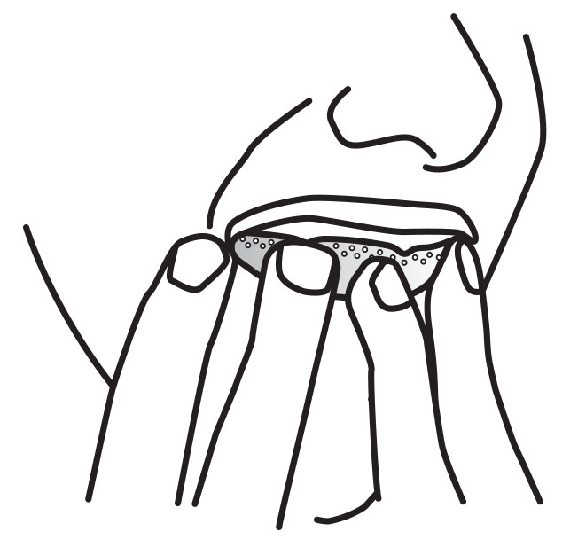 how-to-fit-a-sova-night-guard