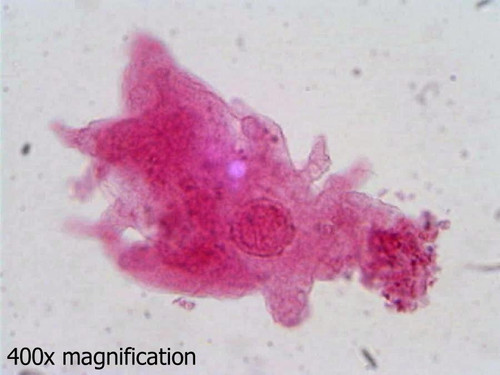 Amoeba proteus slide, w.m.